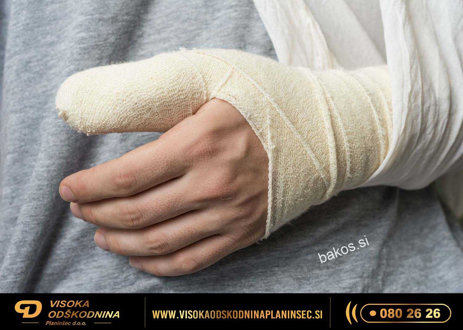 Zaradi lastne nepazljivosti ostal brez prsta - Bakos